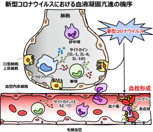 新型コロナウイルスと脳卒中 ｜脳神経外科｜診療科･部門紹介｜香川県立中央病院